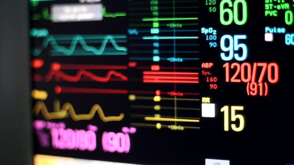 Auscultation of Atrial Fibrillation: A Detailed Guide - Stethoscope