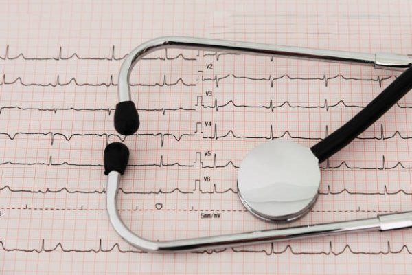 Tips for Positioning a Stethoscope for Accurate Sound Detection ...